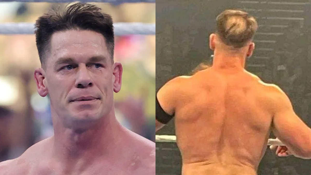Bald Sell-Out John Cena Breaks Silence On Hair Transplant Surgery (WWE ...